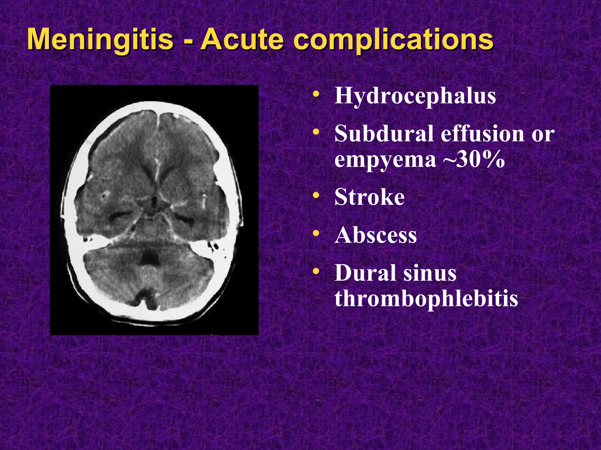 Meningitis.ppt contains information on meningitis | PPT