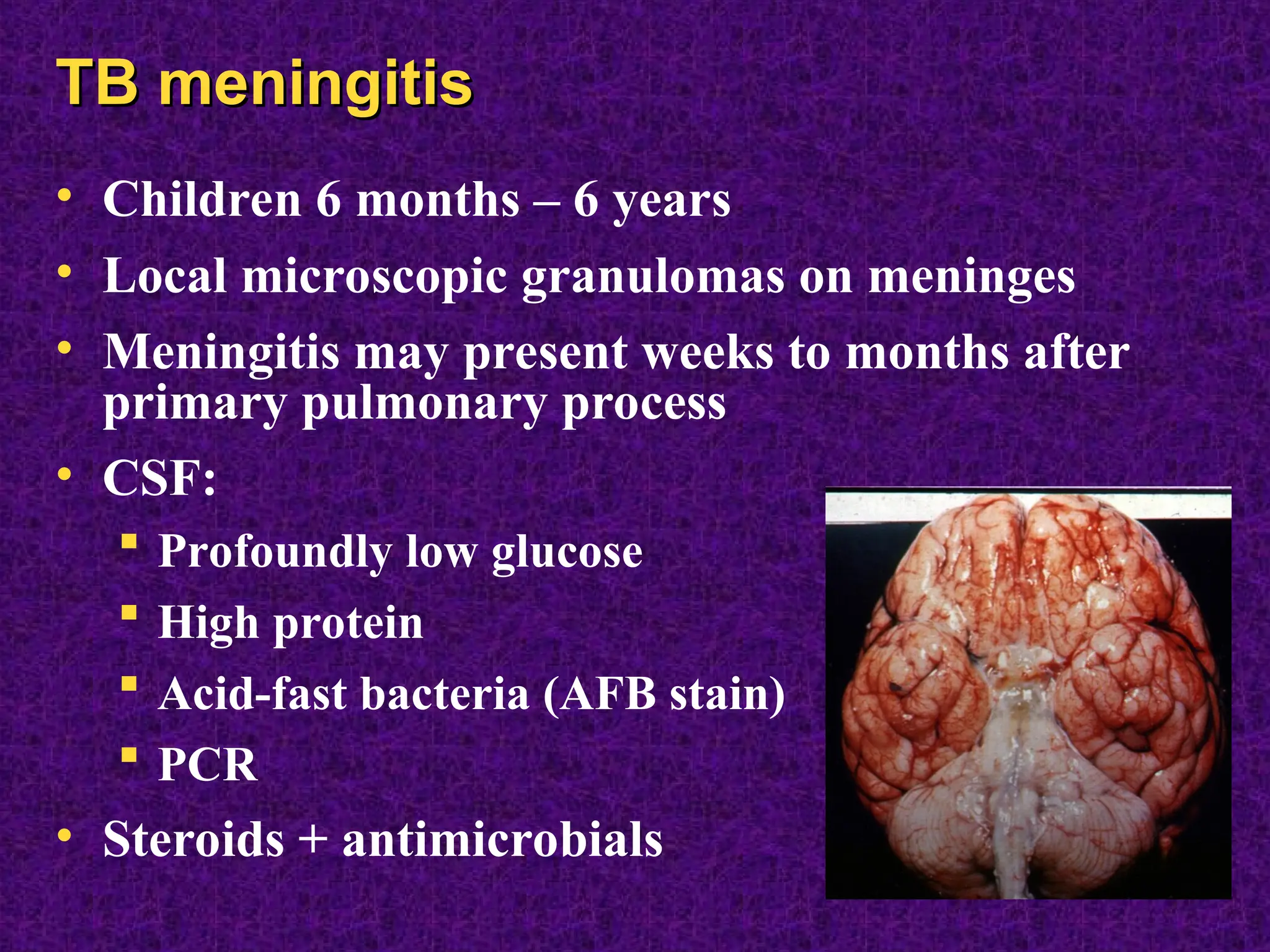 Meningitis.ppt contains information on meningitis | PPT