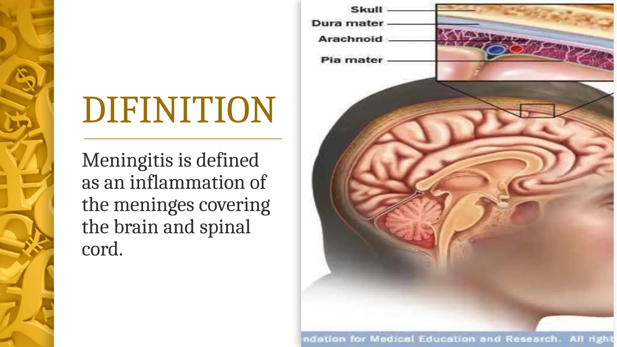 MENINGITIS.ppt introduction to management | PPT