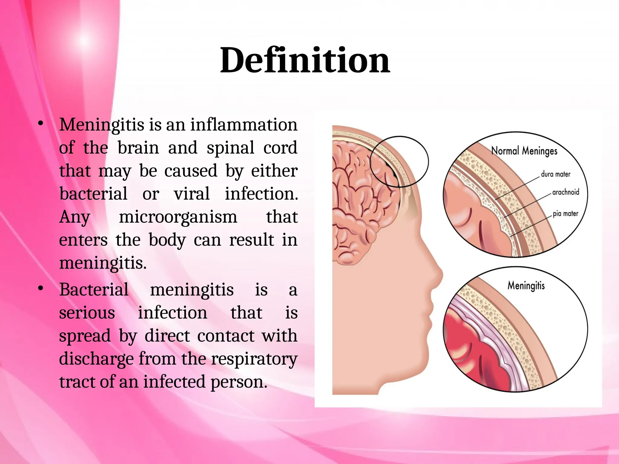 meningitiiiiiiiiiiiiiiiiiiiiiiiiis-.pptx