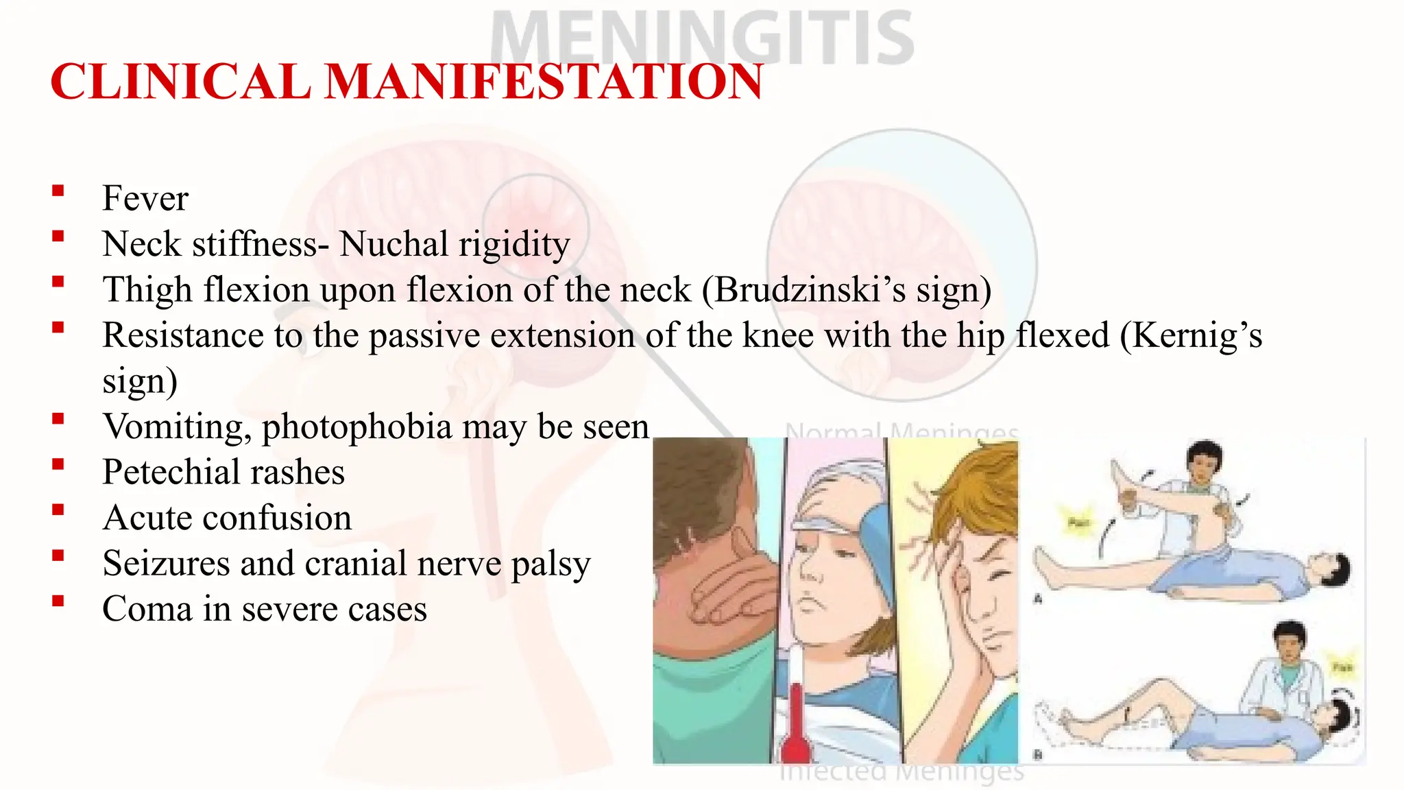 Meningitis, ( UNIT - VI ). AHN - II.pptx