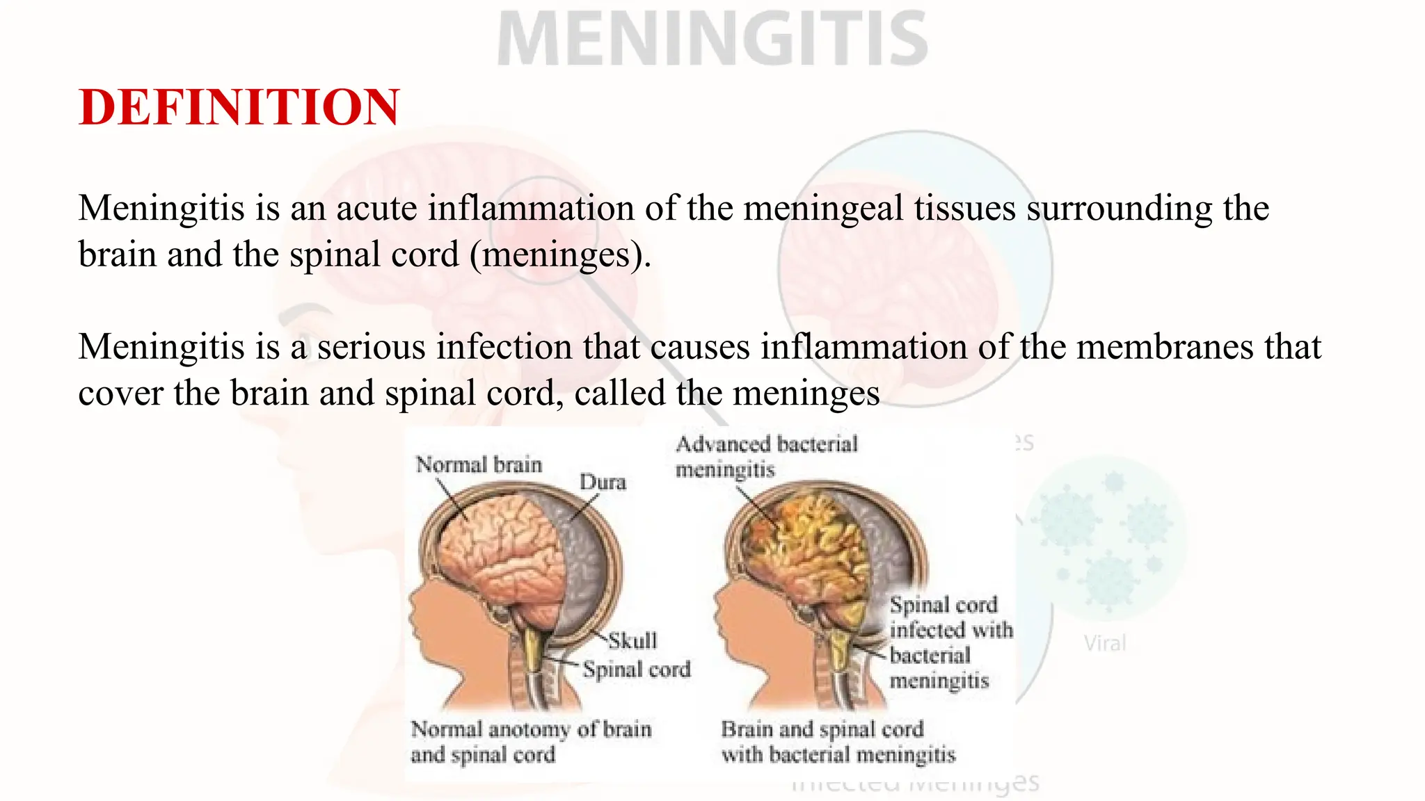 Meningitis, ( UNIT - VI ). AHN - II.pptx
