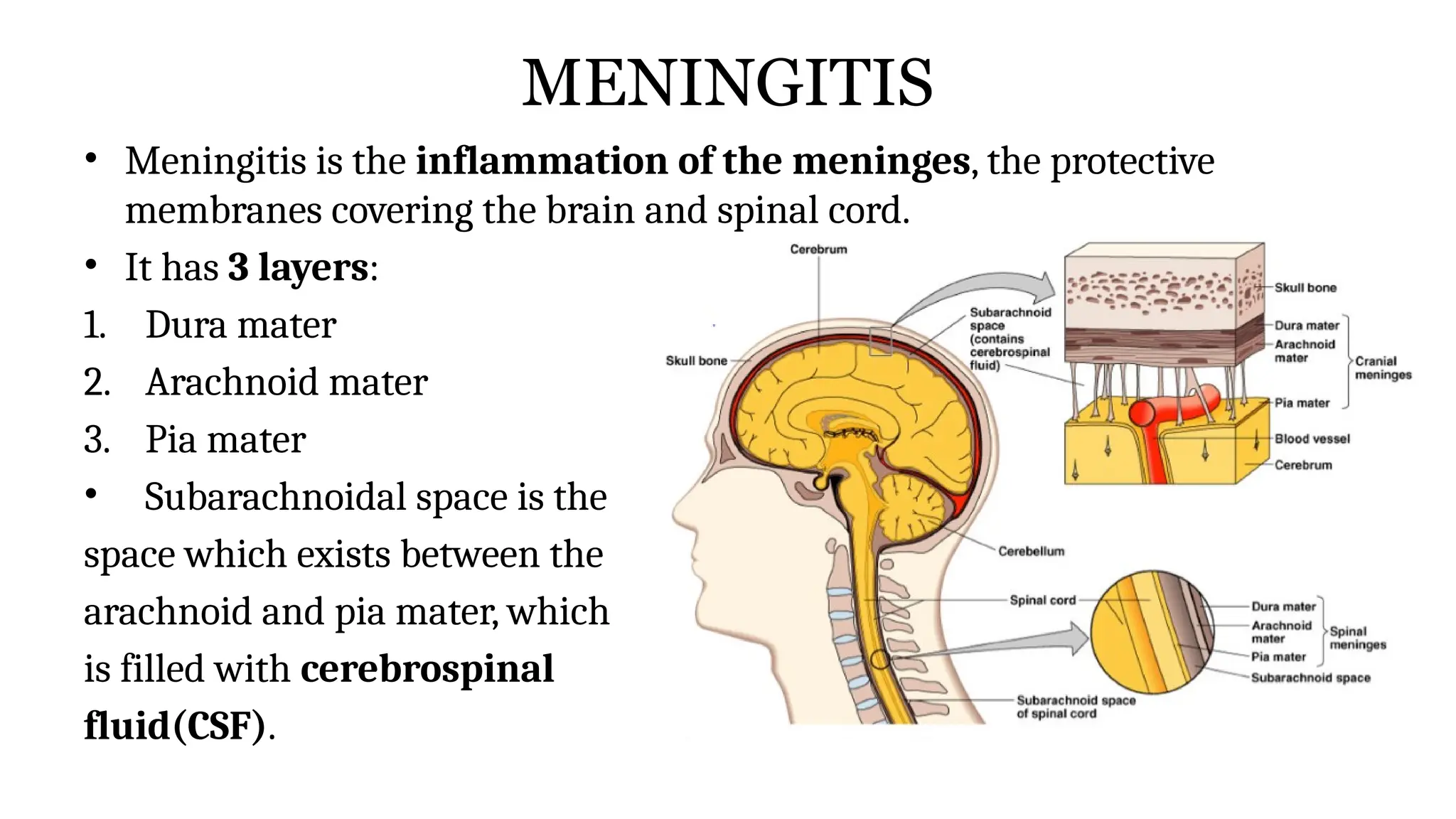 Meningitis / Microbiology / PharmD notes | PPTX