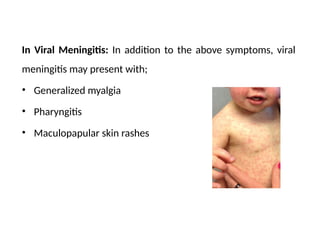 MENINGITIS: NURSING MANAGEMENT, BACTERIAL MENINGITIS, VIRAL MENINGITIS.pptx