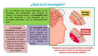 Meningitis bacteriana y viral en Medicina | PPTX