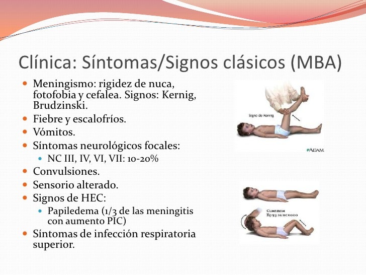 Meningitis Aguda