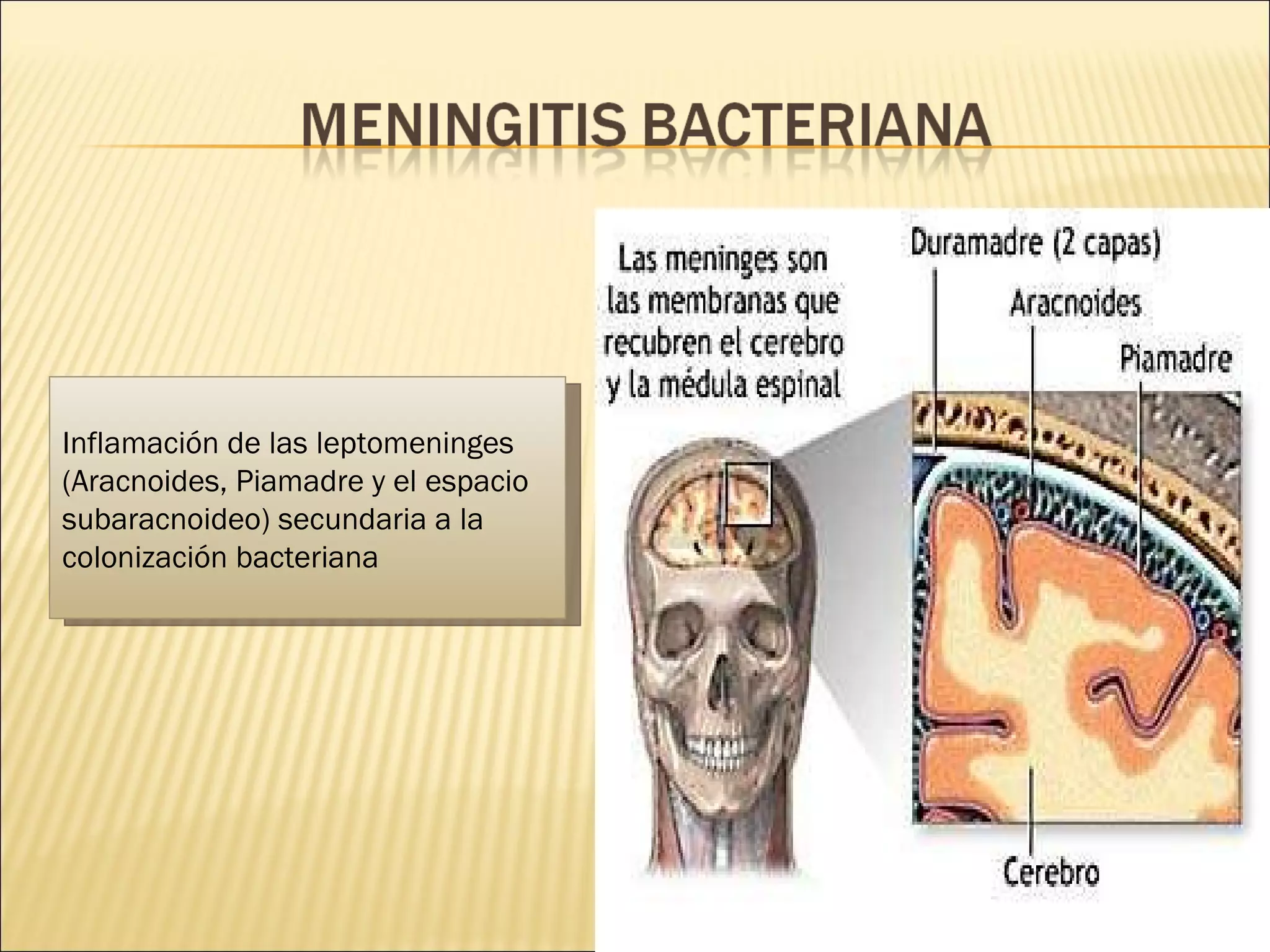 Meningitis Aguda Bacteriana | PPT | Infectious Diseases | Diseases and ...