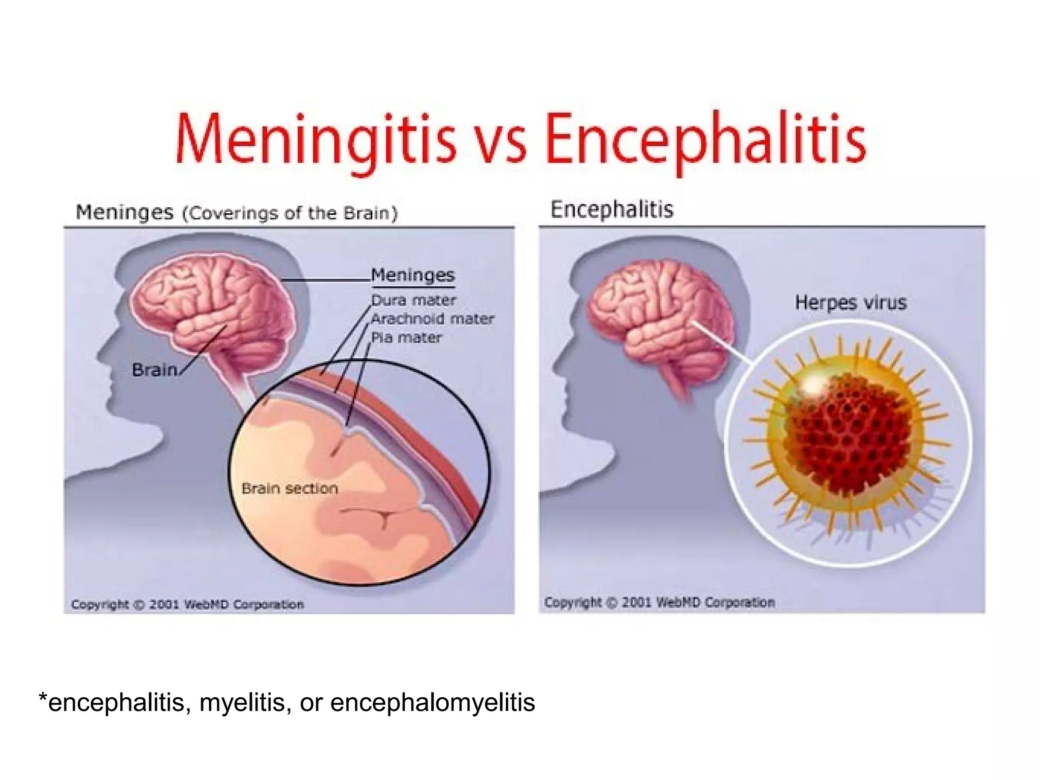 Meningitis and Encephalitis | PPT