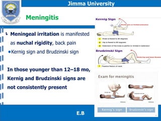 Meningitis and Encephalitis.pptx