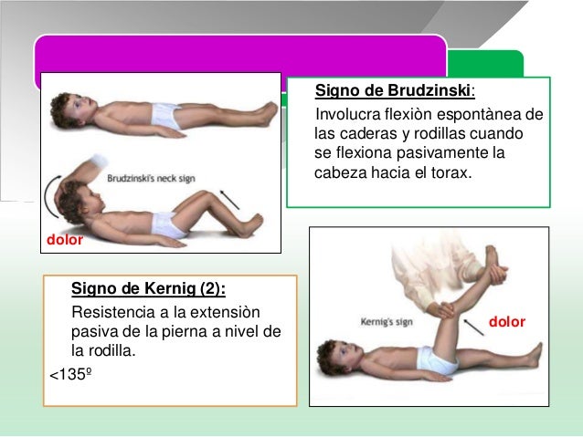 Meningitis bacteriana. jenny