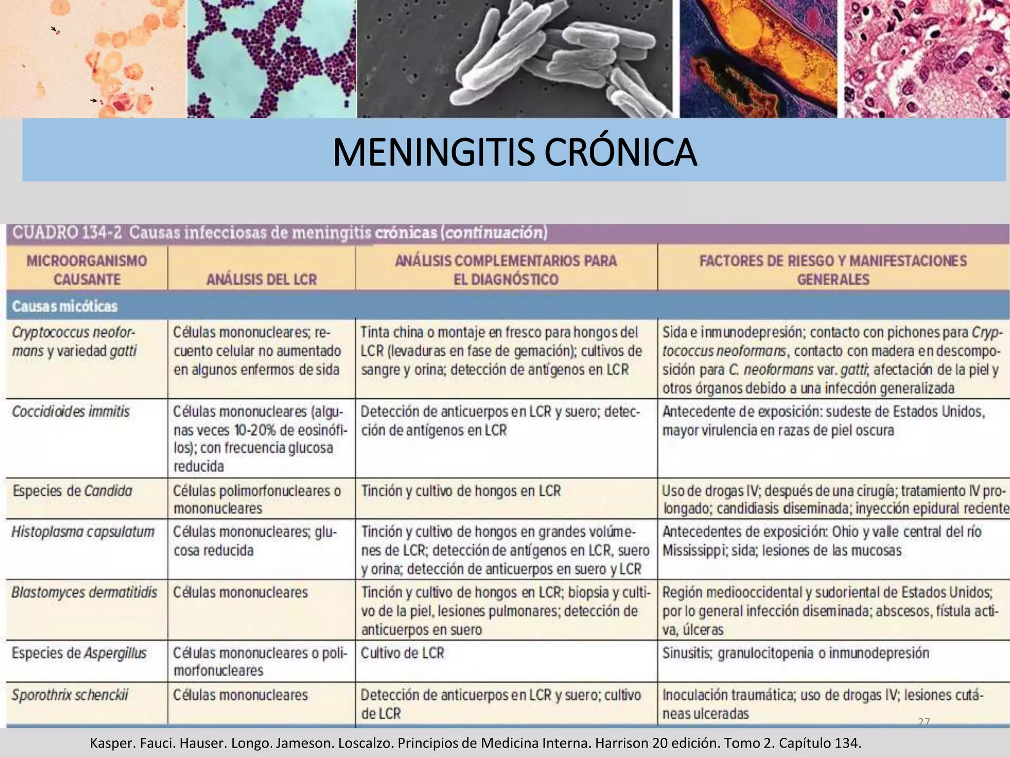 MENINGITIS BACTERIANA AGUDA & ABSCESO CEREBRAL | PPT