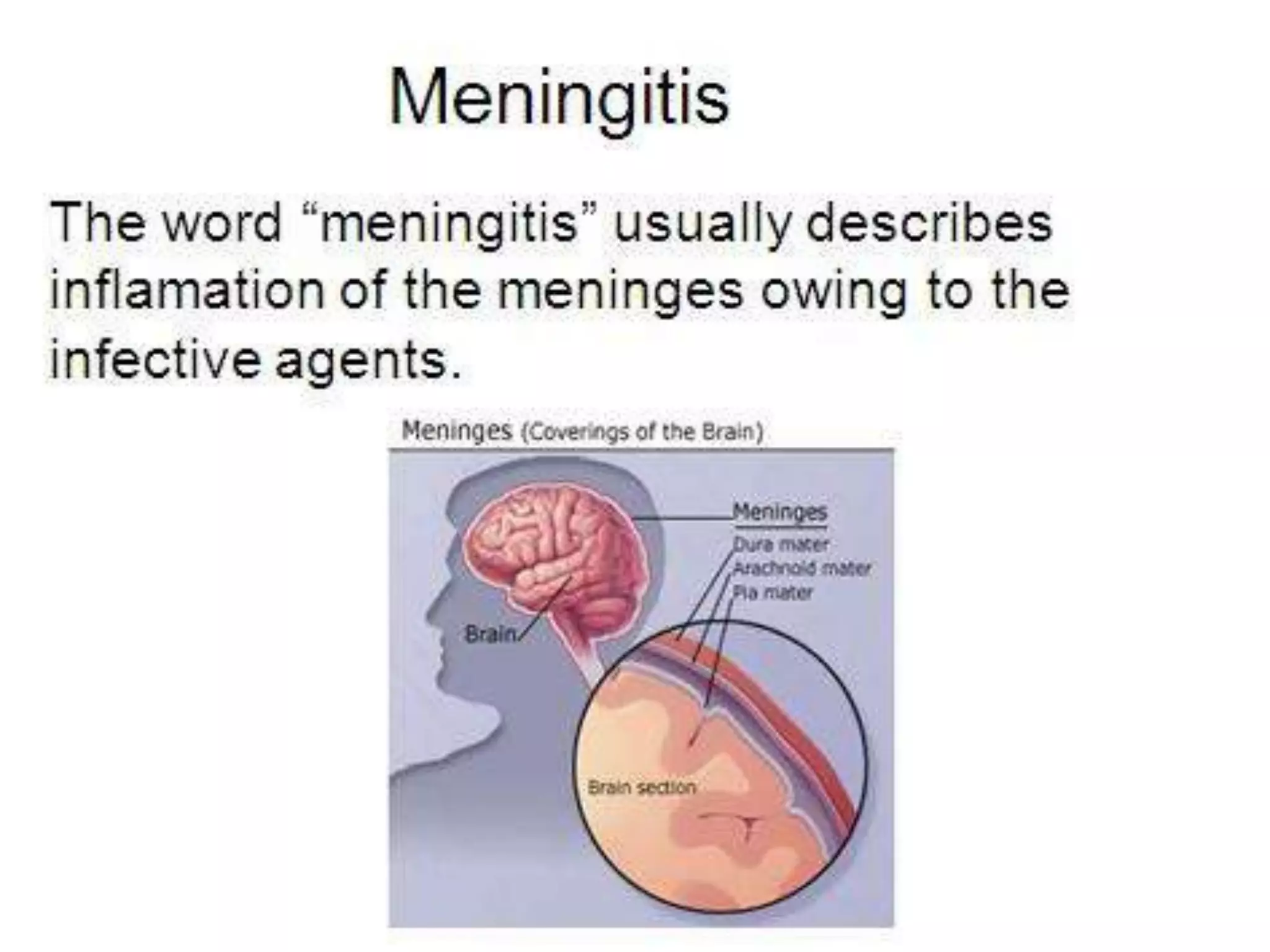 Meningitis brain abscess | PPTX
