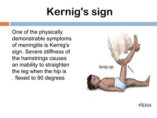 Meningitis by reda said | PPT
