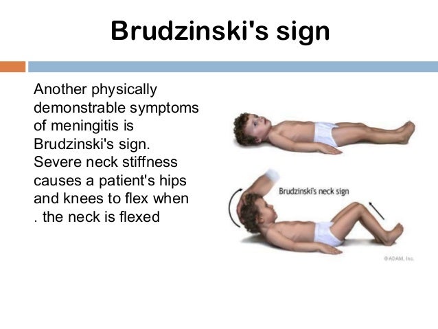 Meningitis by reda said
