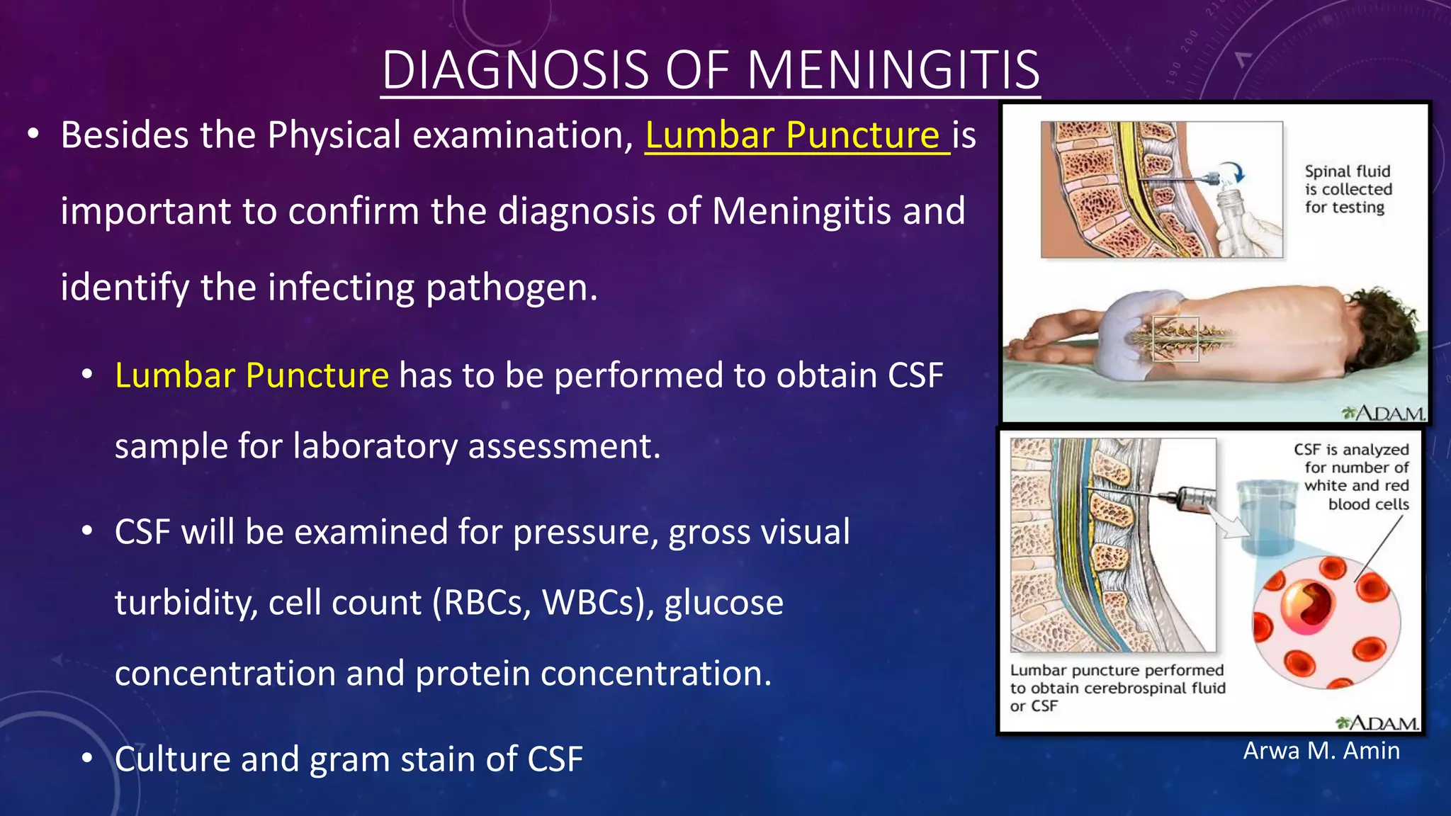 Meningitis | PDF