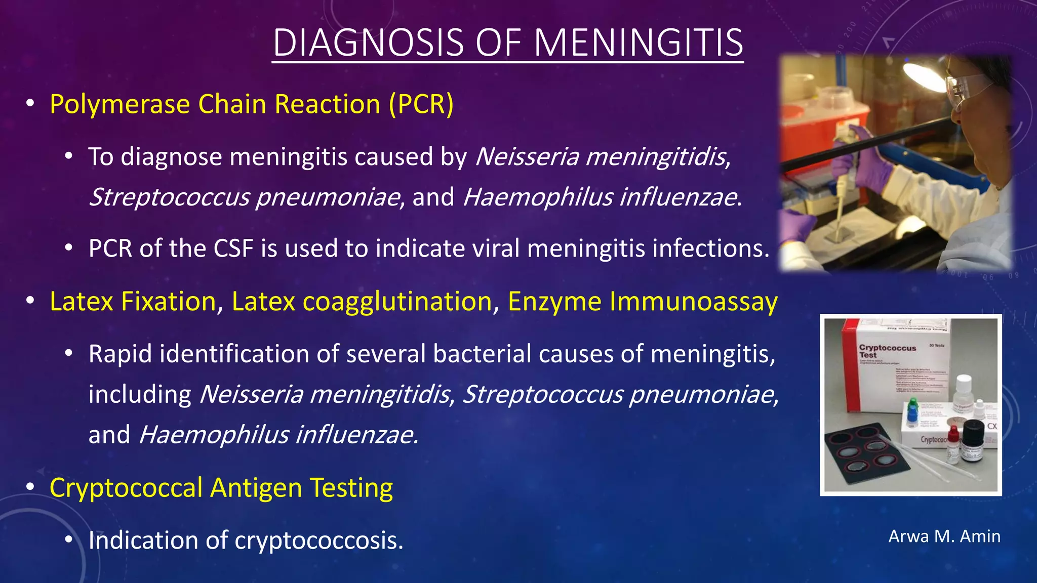 Meningitis | PDF