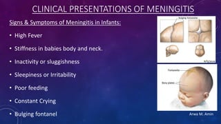 Meningitis | PDF