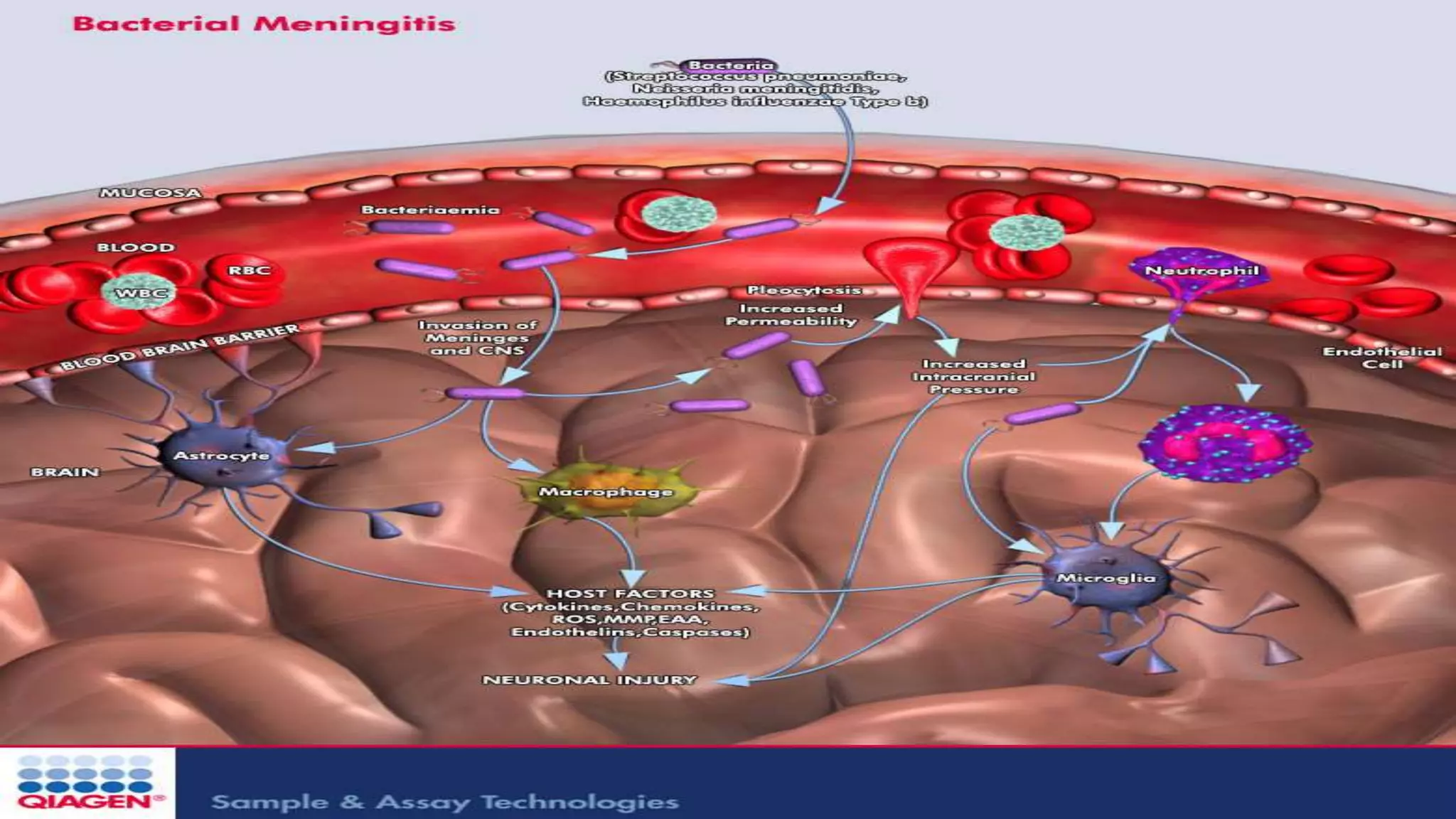 Meningitis final.ppt