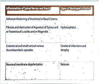 Meningitis in Children - UG Pediatrics.. | PPT