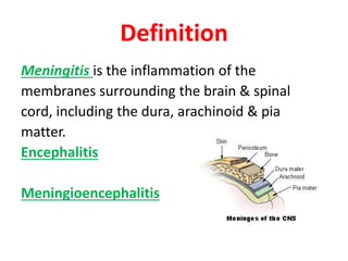 Meningitis in children | PPTX