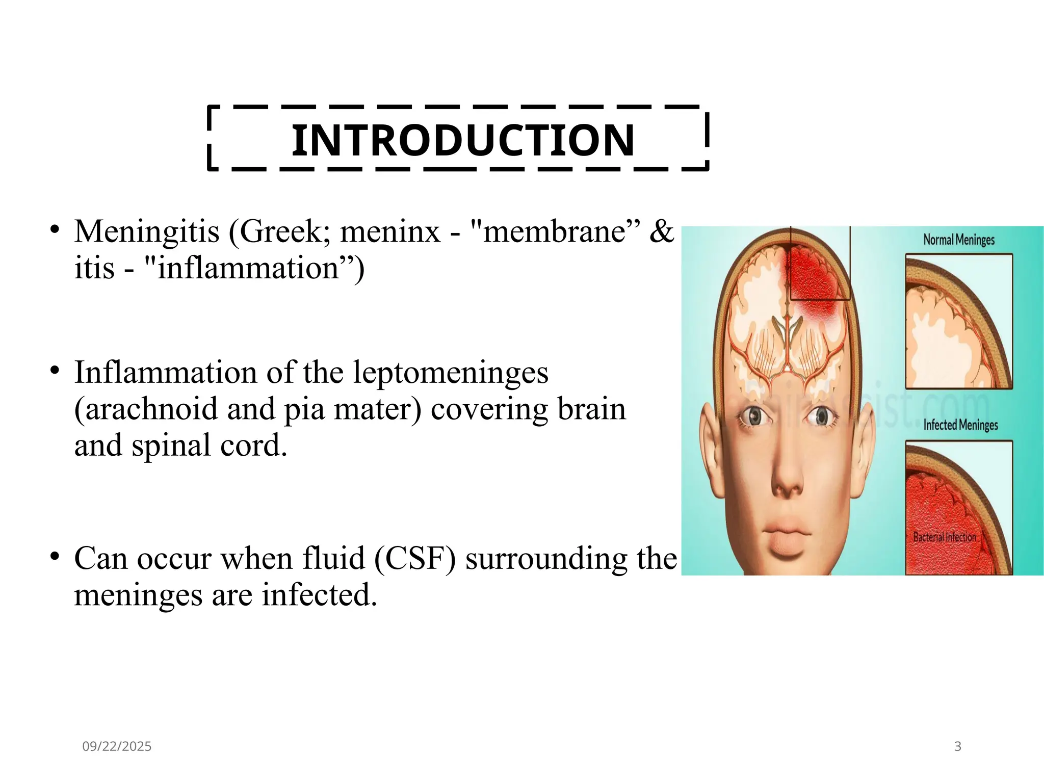 meningitis definition, clinical features intro.ppt