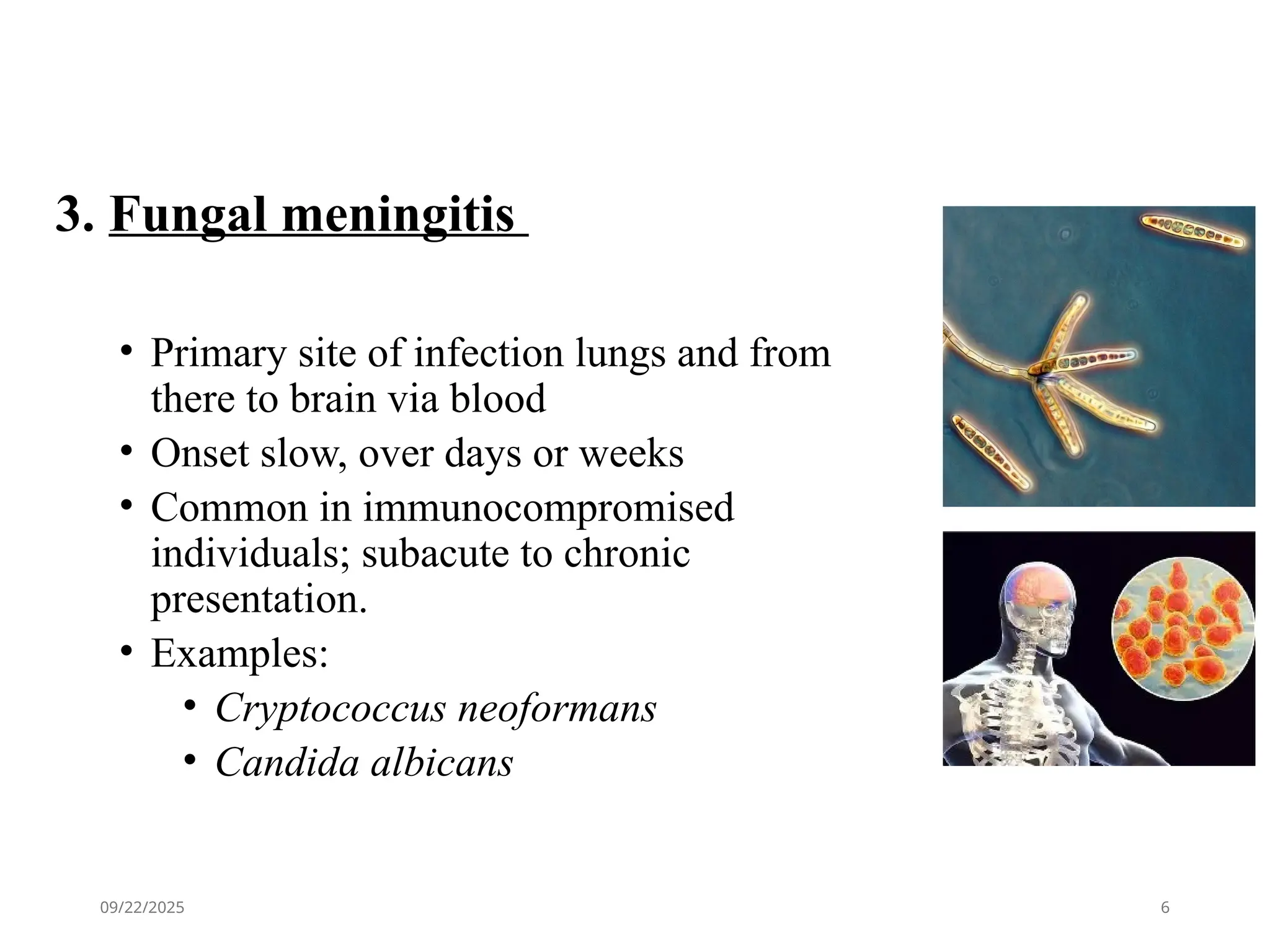 meningitis definition, clinical features intro.ppt