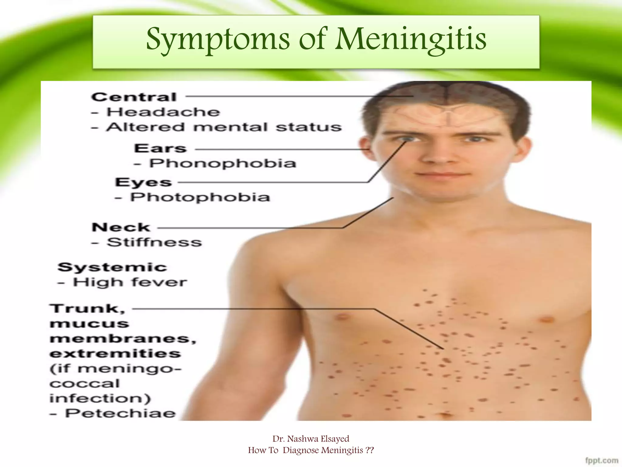 How to Diagnose Meningitis in the Lab ? | PPTX