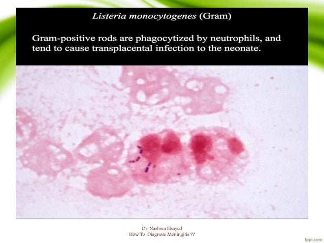 How to Diagnose Meningitis in the Lab ? | PPTX | Blood Disorders ...