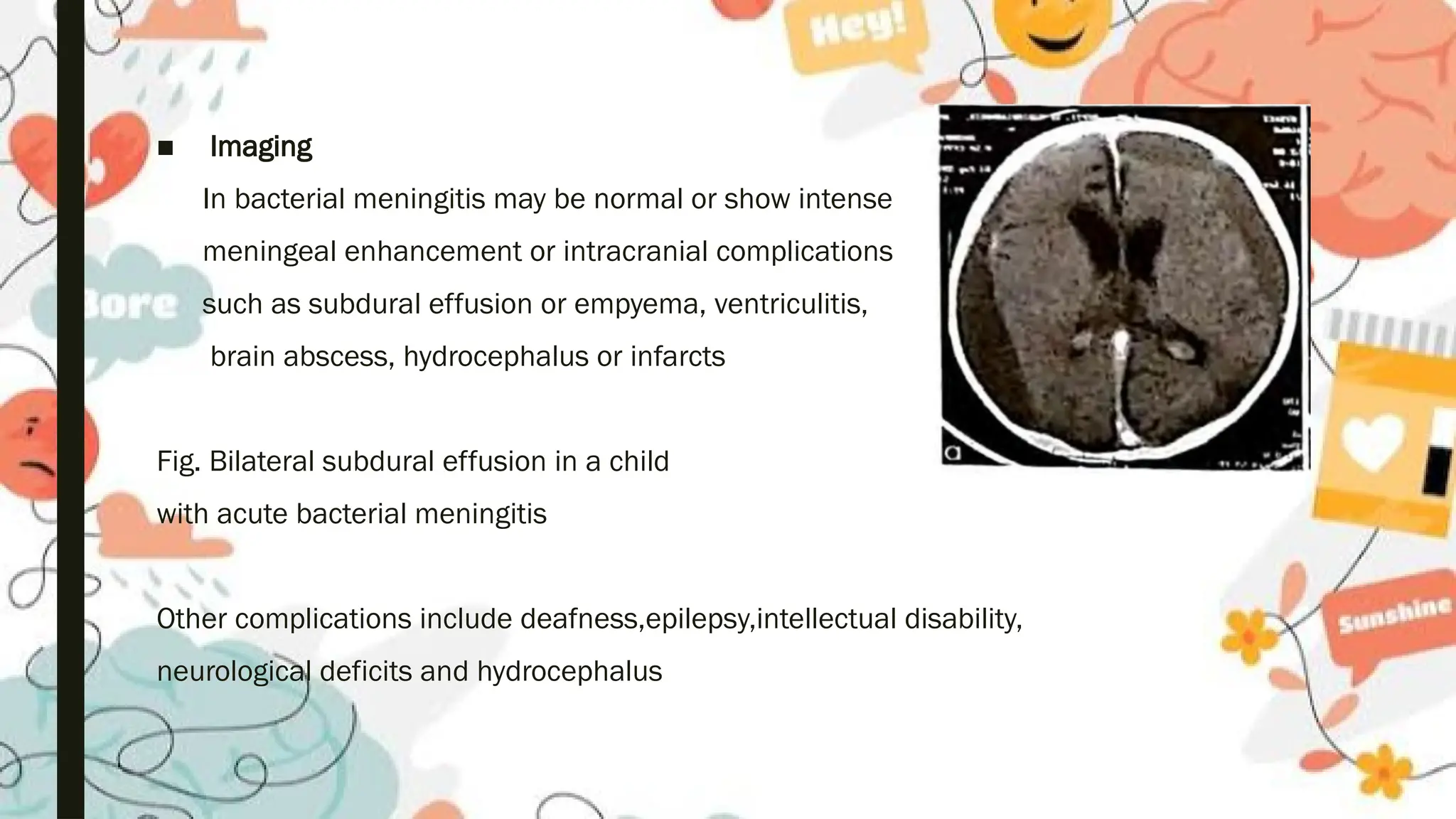 Meningitis New for paediatric undergraduate level (1).pptx