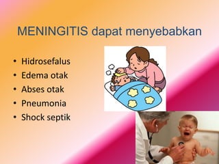 MENINGITIS (pkmrs).pptx