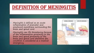 EPIDEMIOLOGY, CONTROL & MANAGEMENT OF MENINGITIS | PDF