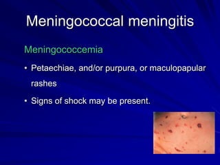 Meningitis by Prof Khin | PPTX
