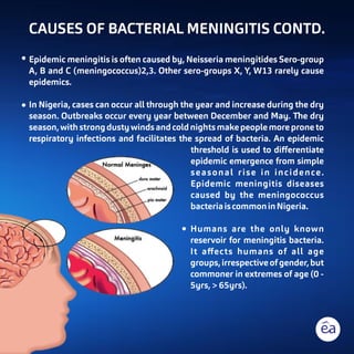 #StaySafe: Alert Points for Meningococcal Meningitis | PDF