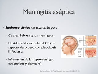 Meningitis viral | PPT
