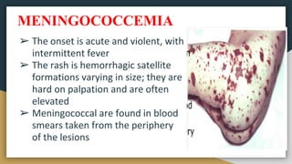 MENINGOCOCCAL INFECTION.pptx