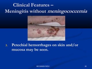 Meningo coccal meningitis | PPTX