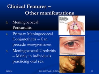 Meningococcal meningitis dr.harivansh chopra | PPT
