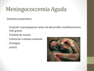 Meningococcemia | PPTX