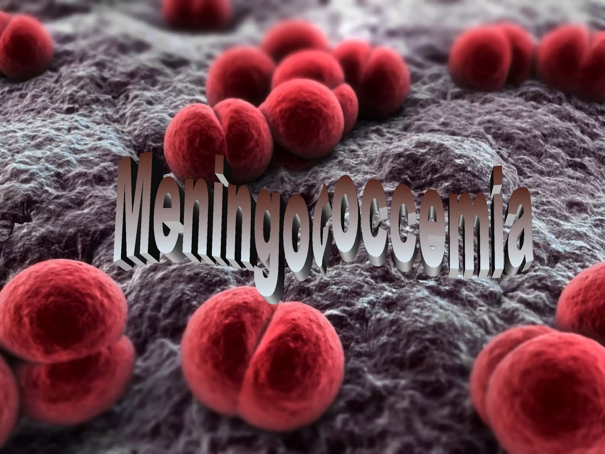 Meningococcemia | PPT