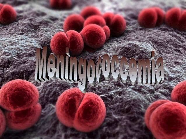 Meningococcemia | PPT