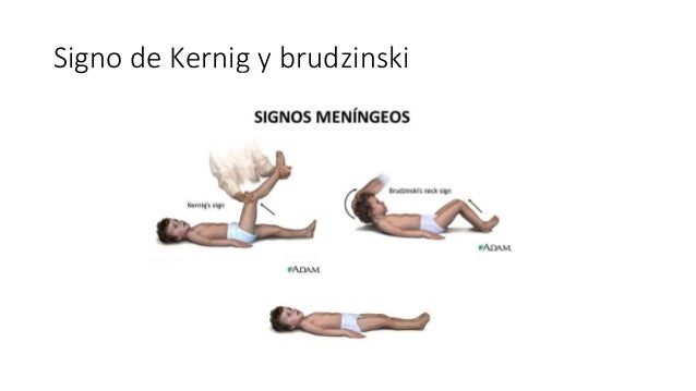 Meningoencefalitis purulenta