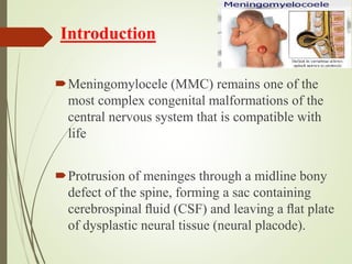 anaesthetic management of Meningomyelocele and its Surgical excision | PPTX