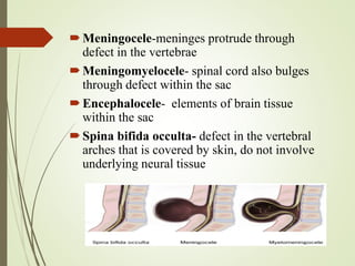 anaesthetic management of Meningomyelocele and its Surgical excision | PPTX