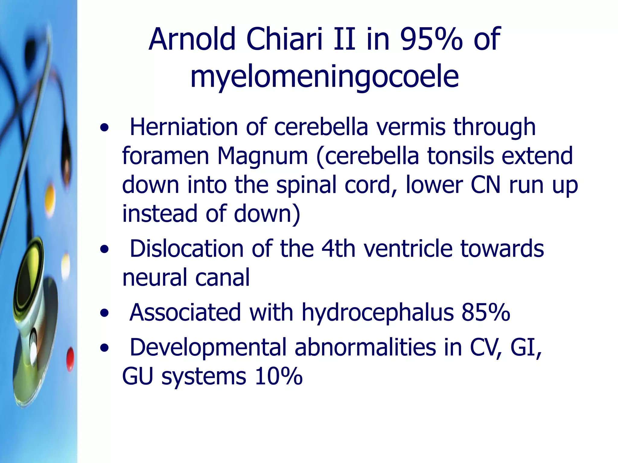 Meningomyelocoele | PPT