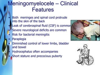 Meningomyelocoele | PPT