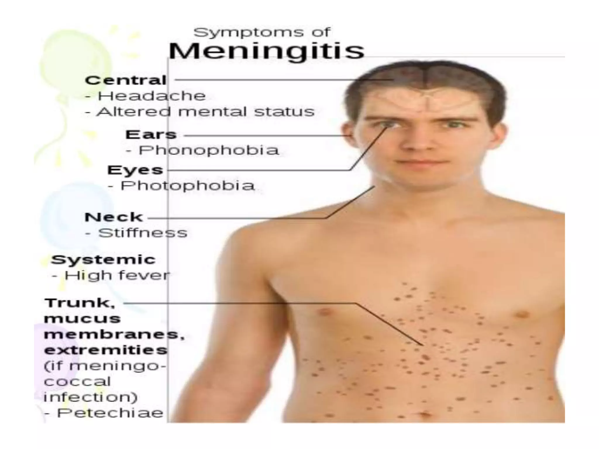 Meninigitis | PPTX | Infectious Diseases | Diseases and Conditions