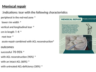 Meniscal Injuries fast review and treatment | PPTX