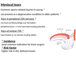Meniscal Injuries fast review and treatment | PPTX