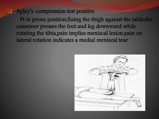 Meniscal injuries | PPT
