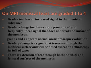 Meniscal injuries | PPTX